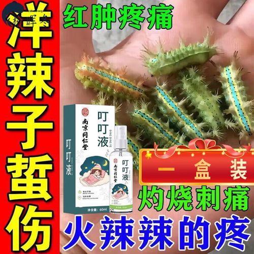 毛毛虫蛰伤怎么缓解疼痛_被毛毛虫蛰了怎么办-第2张图片-山城妙识
