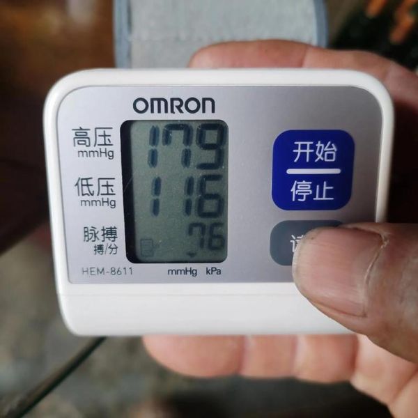 上压160下压100危险吗_高血压160100严重吗-第2张图片-山城妙识