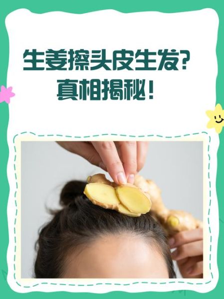 治脱发最有效的土偏方_生姜擦头皮多久见效-第3张图片-山城妙识