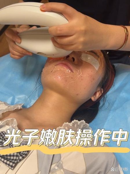 激光美白全身多少钱_全身激光美白价格贵吗-第3张图片-山城妙识