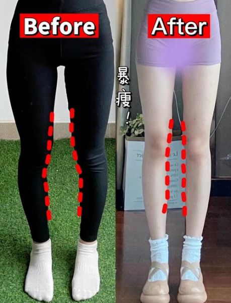 一天秒变筷子腿_真的可能吗-第3张图片-山城妙识