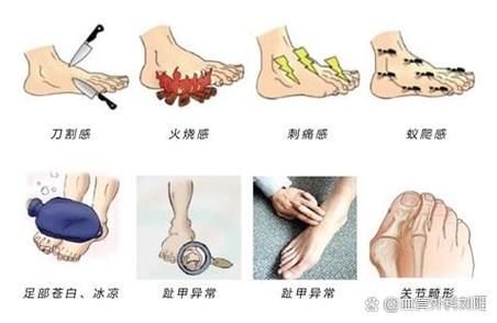 年轻人糖尿病早期症状有哪些_怎么判断是不是糖尿病-第2张图片-山城妙识 年轻人糖尿病早期症状有哪些_怎么判断是不是糖尿病-第2张图片-山城妙识