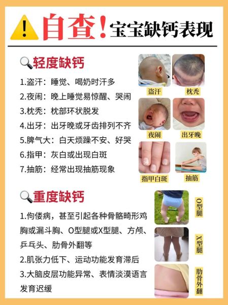 如何科学补钙_缺钙有哪些症状-第1张图片-山城妙识 如何科学补钙_缺钙有哪些症状-第1张图片-山城妙识