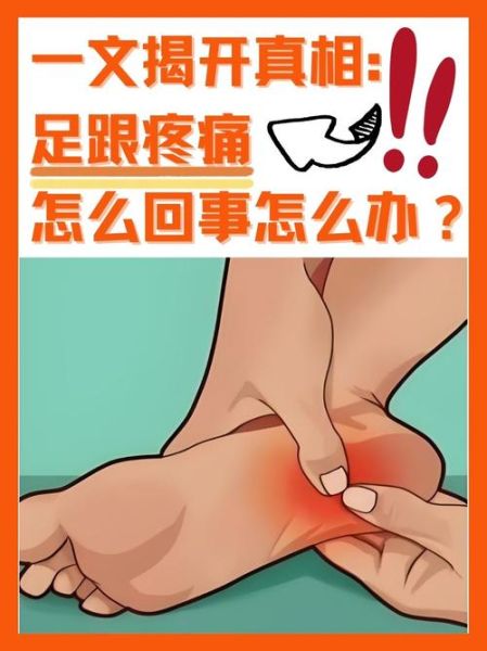 foot疼痛是怎么回事_foot疼痛如何缓解-第1张图片-山城妙识