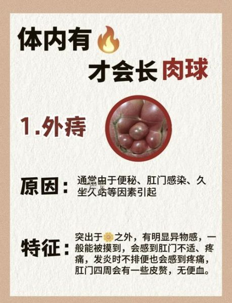 痔疮肉球缩回去小窍门_痔疮肉球怎么消除-第1张图片-山城妙识