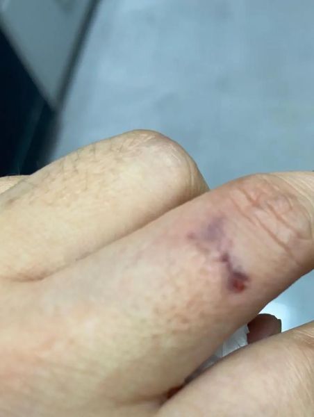 螃蟹怎么抓不会被夹_抓螃蟹不夹手技巧-第2张图片-山城妙识