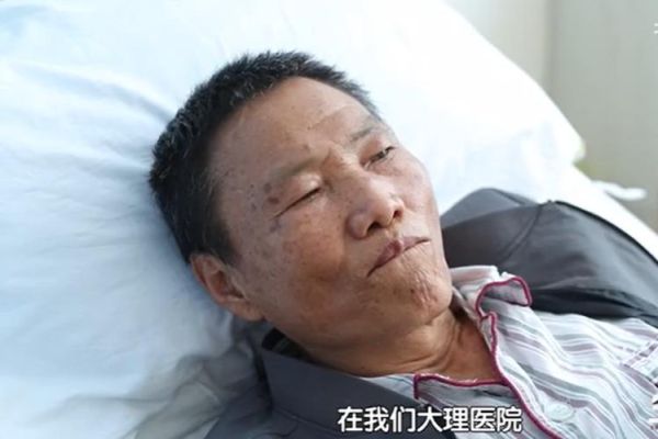 肝硬化晚期死前6个月征兆_还能活多久-第1张图片-山城妙识