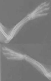 脆骨病图片_脆骨病症状图片-第1张图片-山城妙识 脆骨病图片_脆骨病症状图片-第1张图片-山城妙识