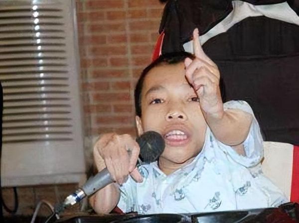 脆骨病图片_脆骨病症状图片-第2张图片-山城妙识 脆骨病图片_脆骨病症状图片-第2张图片-山城妙识