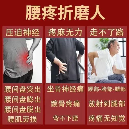 腰间盘突出吃什么药好_腰突止痛药推荐-第2张图片-山城妙识 腰间盘突出吃什么药好_腰突止痛药推荐-第2张图片-山城妙识