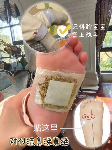 炒姜末敷脚心多久见效_宝宝流鼻涕能用吗-第3张图片-山城妙识 炒姜末敷脚心多久见效_宝宝流鼻涕能用吗-第3张图片-山城妙识