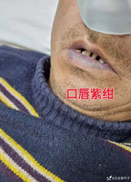 咸菜亚硝酸盐中毒症状_如何快速识别-第1张图片-山城妙识 咸菜亚硝酸盐中毒症状_如何快速识别-第1张图片-山城妙识