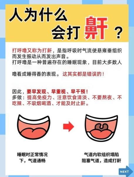 打呼噜怎么治疗见效最快_止鼾小妙招有哪些-第2张图片-山城妙识 打呼噜怎么治疗见效最快_止鼾小妙招有哪些-第2张图片-山城妙识