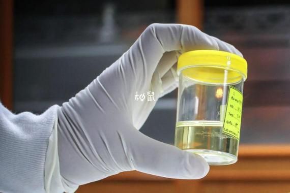 怀孕尿里加醋测男女准吗_怀孕尿里加醋测男女准确率-第2张图片-山城妙识