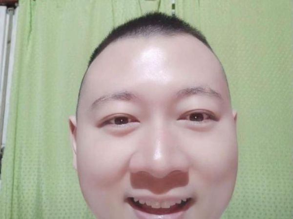 卤蛋头怎么剪_卤蛋头适合什么脸型-第2张图片-山城妙识 卤蛋头怎么剪_卤蛋头适合什么脸型-第2张图片-山城妙识