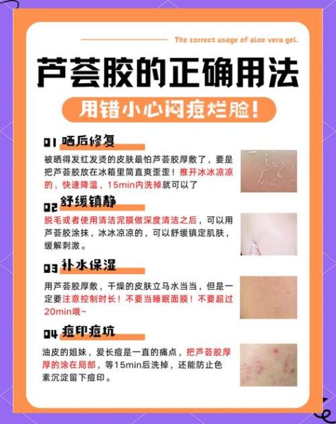芦荟胶能祛痘吗_芦荟胶能去痘印吗-第1张图片-山城妙识 芦荟胶能祛痘吗_芦荟胶能去痘印吗-第1张图片-山城妙识