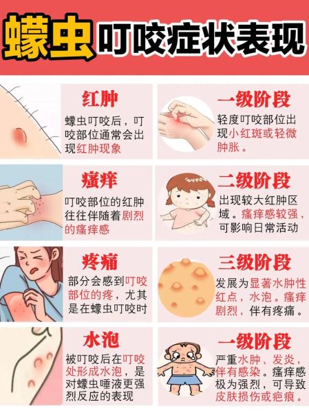 最吓人的虫子有哪些_如何防止被咬-第2张图片-山城妙识 最吓人的虫子有哪些_如何防止被咬-第2张图片-山城妙识