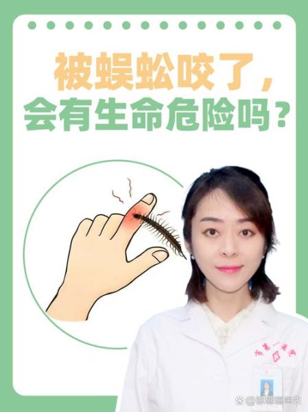 最吓人的虫子有哪些_如何防止被咬-第3张图片-山城妙识 最吓人的虫子有哪些_如何防止被咬-第3张图片-山城妙识