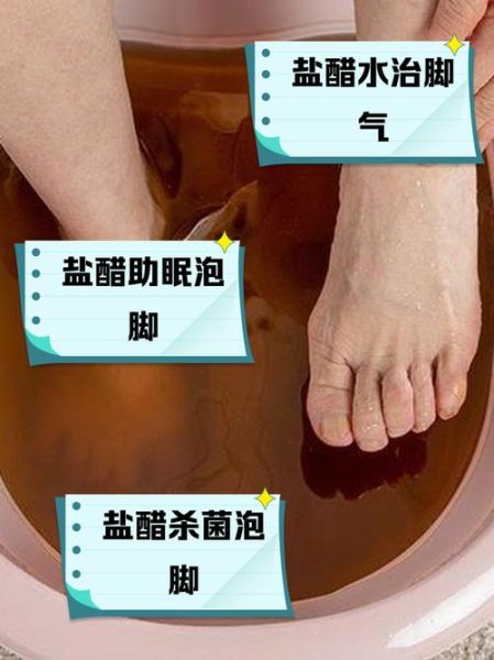 醋泡脚能治脚气吗_醋泡脚的正确方法-第1张图片-山城妙识