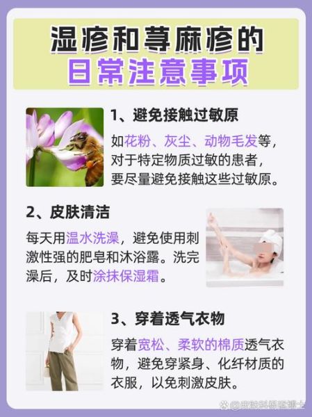 皮肤过敏症状图片_怎么判断是不是荨麻疹-第1张图片-山城妙识 皮肤过敏症状图片_怎么判断是不是荨麻疹-第1张图片-山城妙识