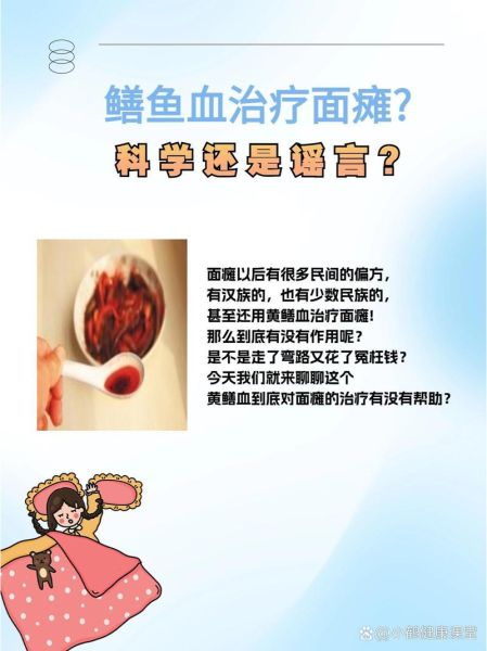 面瘫涂鳝鱼血最正确的方法_鳝鱼血治面瘫多久见效-第2张图片-山城妙识 面瘫涂鳝鱼血最正确的方法_鳝鱼血治面瘫多久见效-第2张图片-山城妙识