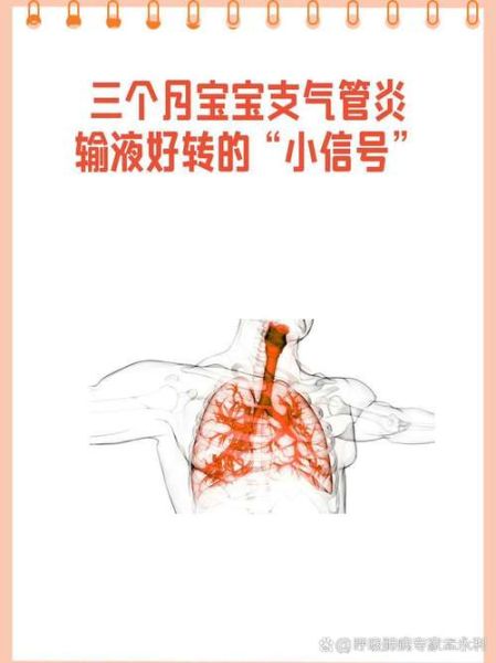 支气管炎多久能好_支气管炎好转的三个阶段-第2张图片-山城妙识 支气管炎多久能好_支气管炎好转的三个阶段-第2张图片-山城妙识