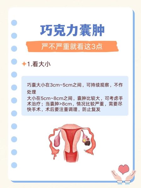 巧克力囊肿会影响怀孕吗_巧克力囊肿怎么治疗最好-第1张图片-山城妙识 巧克力囊肿会影响怀孕吗_巧克力囊肿怎么治疗最好-第1张图片-山城妙识