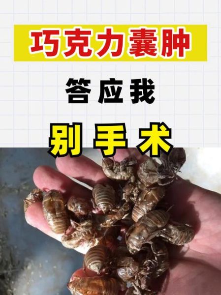 巧克力囊肿会影响怀孕吗_巧克力囊肿怎么治疗最好-第2张图片-山城妙识 巧克力囊肿会影响怀孕吗_巧克力囊肿怎么治疗最好-第2张图片-山城妙识