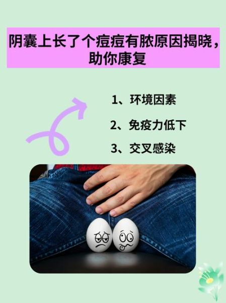 蛋皮上长疙瘩怎么办_阴囊疙瘩原因及处理-第1张图片-山城妙识 蛋皮上长疙瘩怎么办_阴囊疙瘩原因及处理-第1张图片-山城妙识