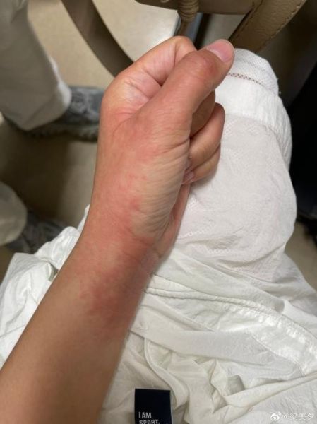 菠萝什么人不能吃_吃菠萝过敏怎么办-第1张图片-山城妙识 菠萝什么人不能吃_吃菠萝过敏怎么办-第1张图片-山城妙识