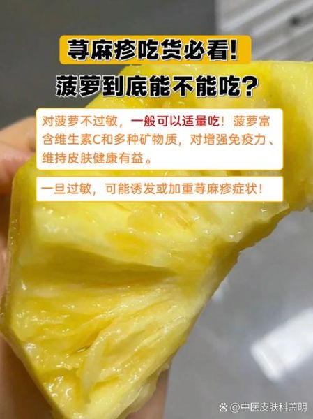菠萝什么人不能吃_吃菠萝过敏怎么办-第2张图片-山城妙识 菠萝什么人不能吃_吃菠萝过敏怎么办-第2张图片-山城妙识